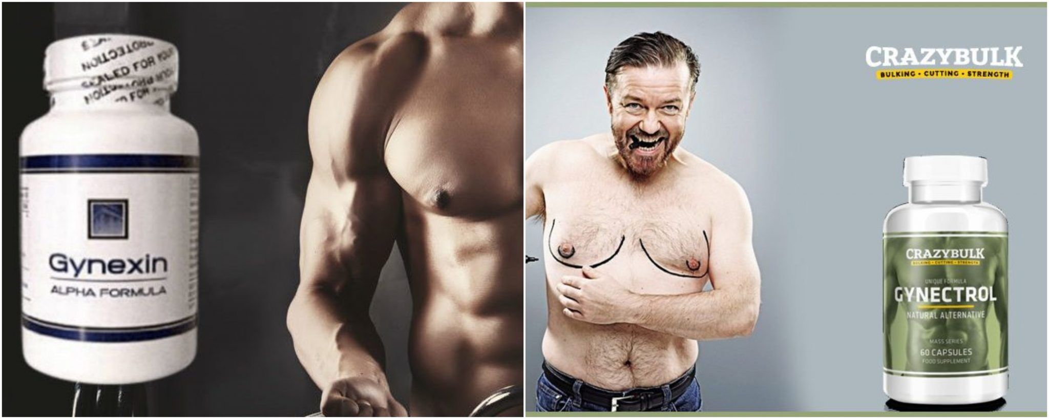 What is Gynecomastia? The Complete Guide & Important Facts